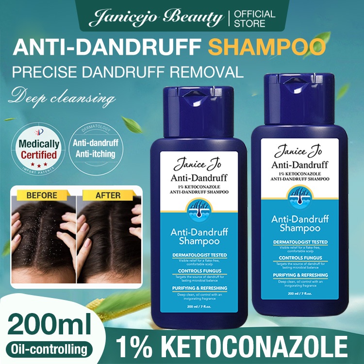 [HOT] Ketoconazole Shampoo 200ml Anti Dandruff Oil Control Anti Fungal ...