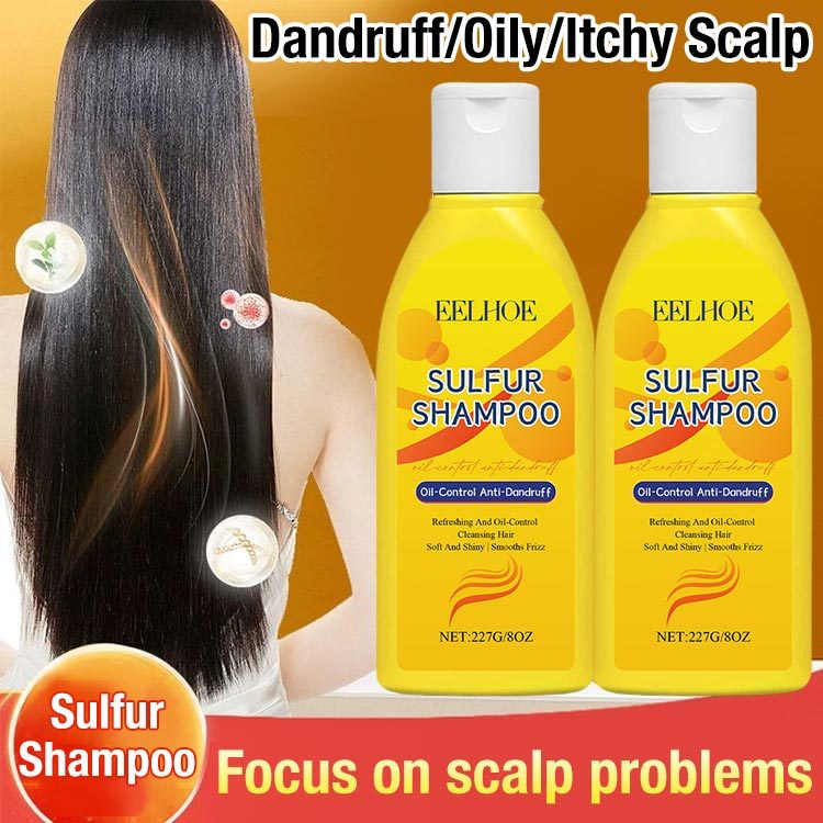 Sulfur Anti Dandruff Oil Control Shampoo Soothes Irritation Anti-Fungal ...