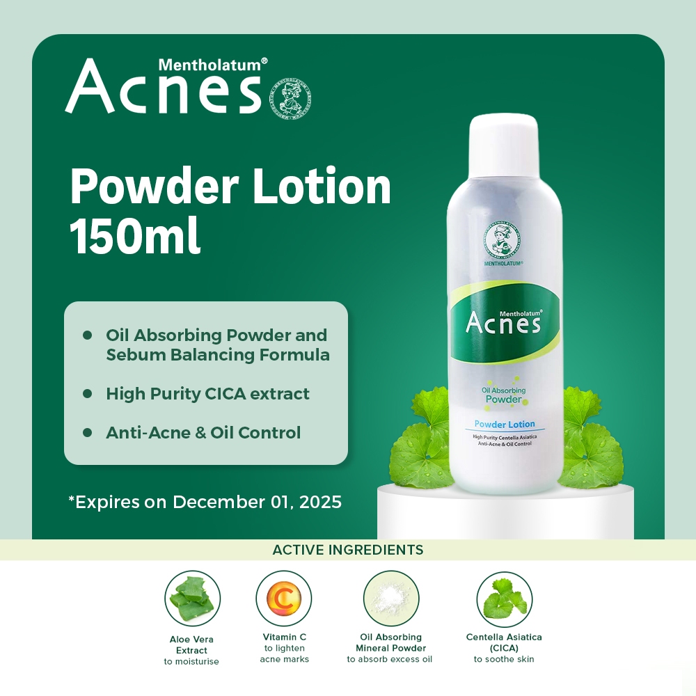 Acnes Powder Lotion 150ml (December 01, 2025 Expiry) | Shopee Philippines