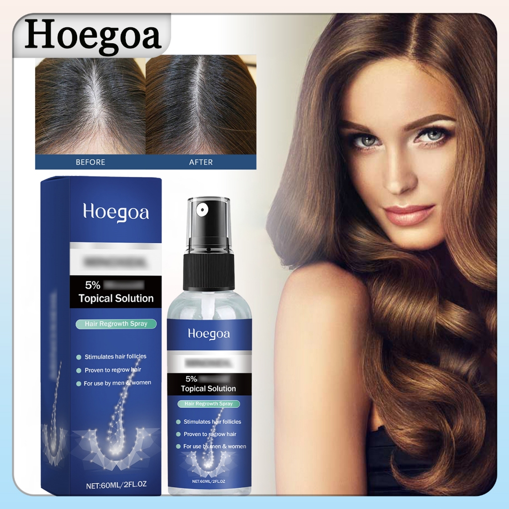 Hoegoa Minoxidil Hair Regrowth Spray 60ml Proven to regrow hair For use ...