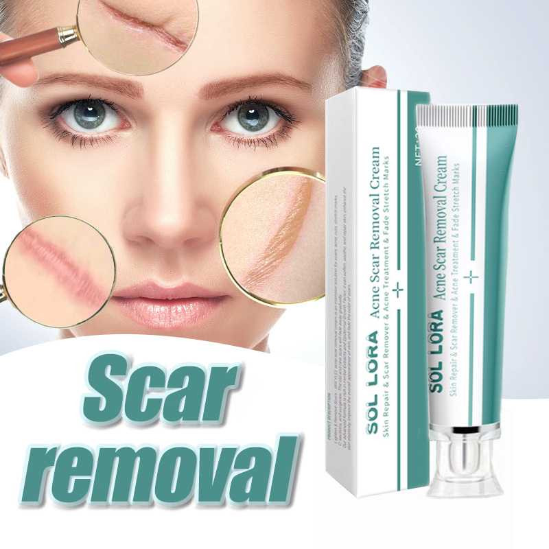 SOL LORA 30g pimple remover cream keloid scar cream remover original pampatanggal ng peklat ...