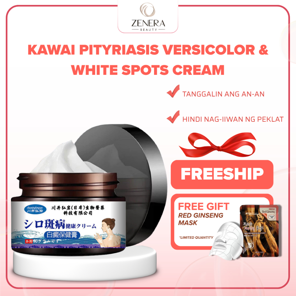 Kawai Pityriasis Versicolor & White Spots Cream - Mabisang Solusyon ...