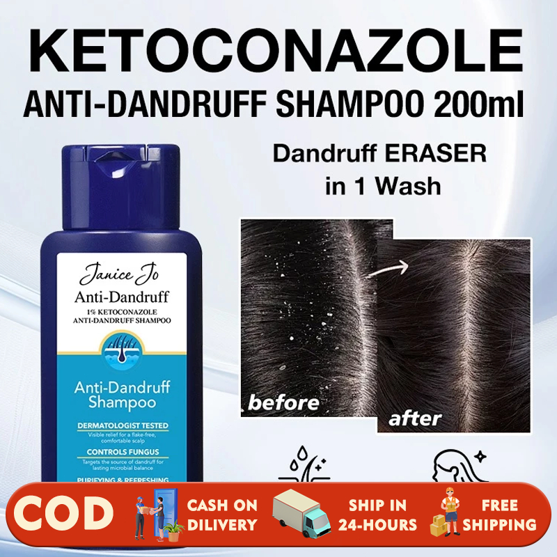 1% Ketonazole Anti Dandruff Shampoo 200ml Dandruff Remover Treatment ...