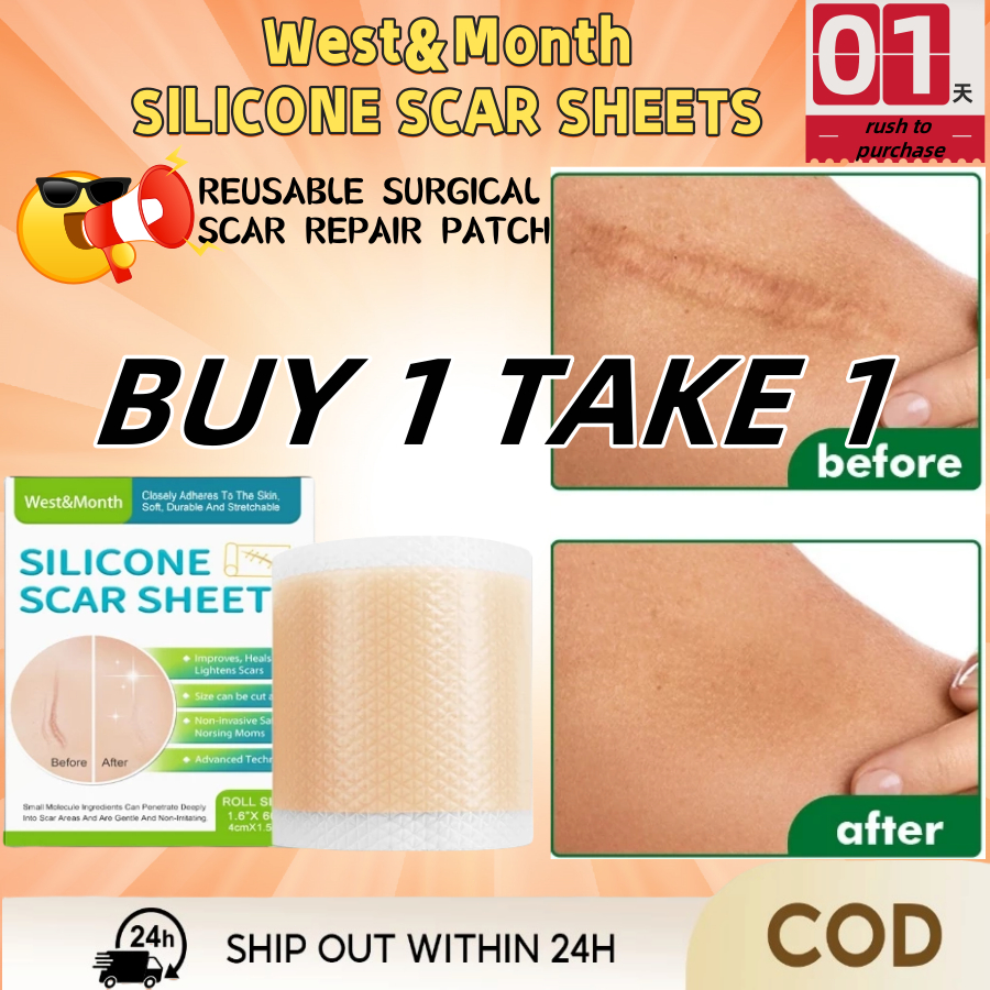 West&Month Silicone Scar Sheet 4*150cm Scar Cover Patch For Surgical ...