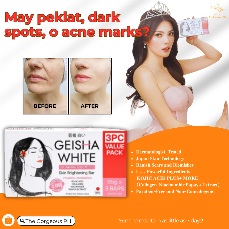Geisha White Brightening Bar Soap - Scar & Blemish Care (3 Bars x 65g ...