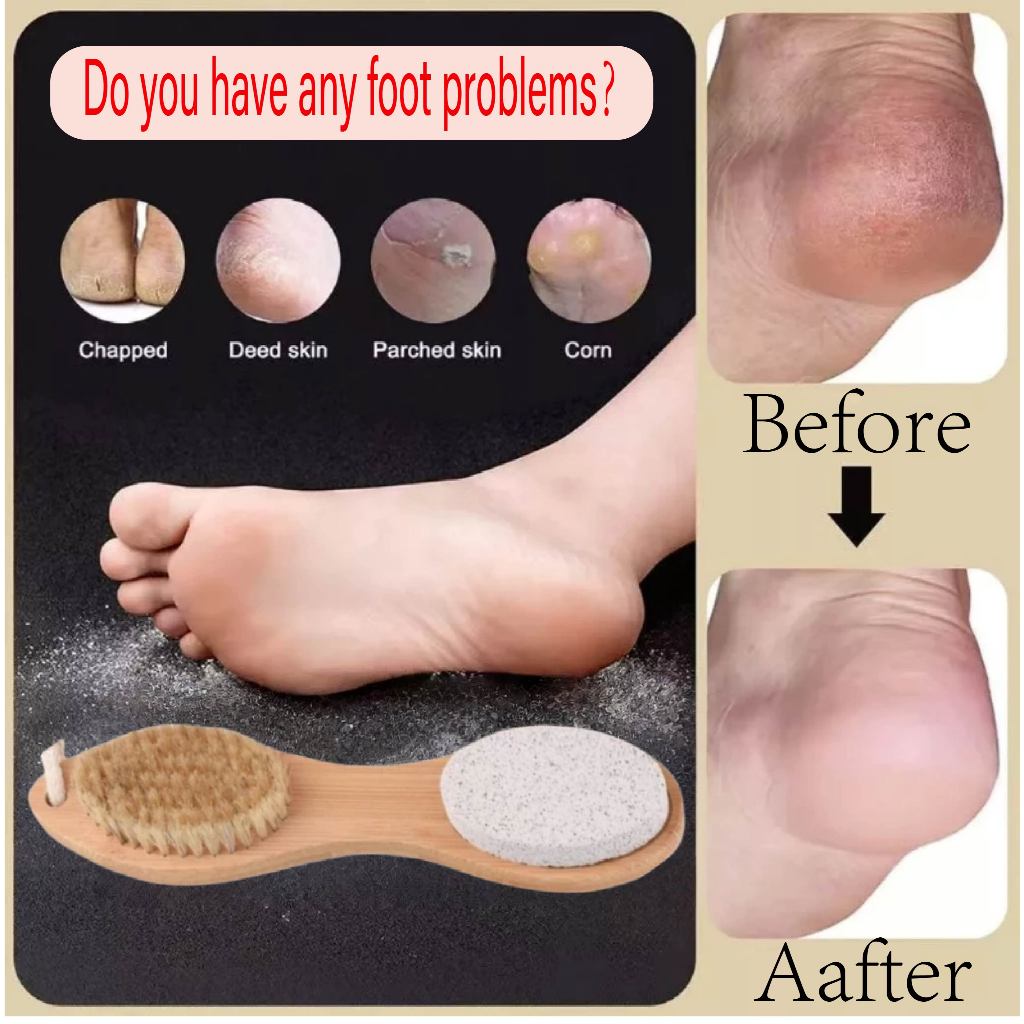 4-in-1 Foot Care Tool: Pumice Stone, Dead Skin Remover, Pedicure ...