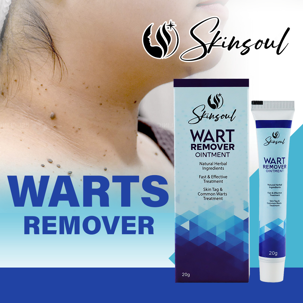 Skinsoul Warts Remover Original Kasoy Cream Wart Removal Kulugo Remover ...