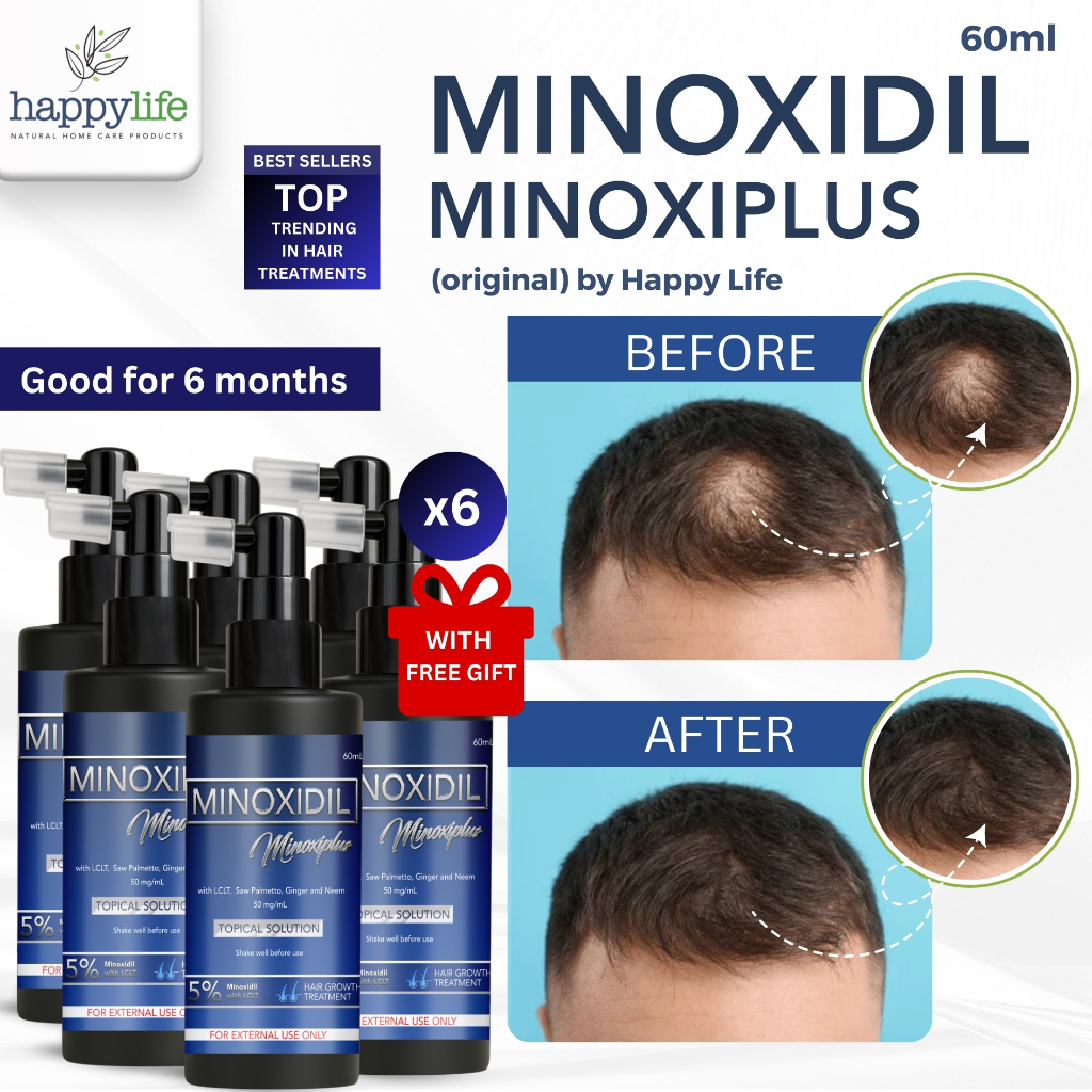 6pcs Minoxidil 5% MINOXIPLUS LCLT Hair Grower, Serum, Men, Women ...