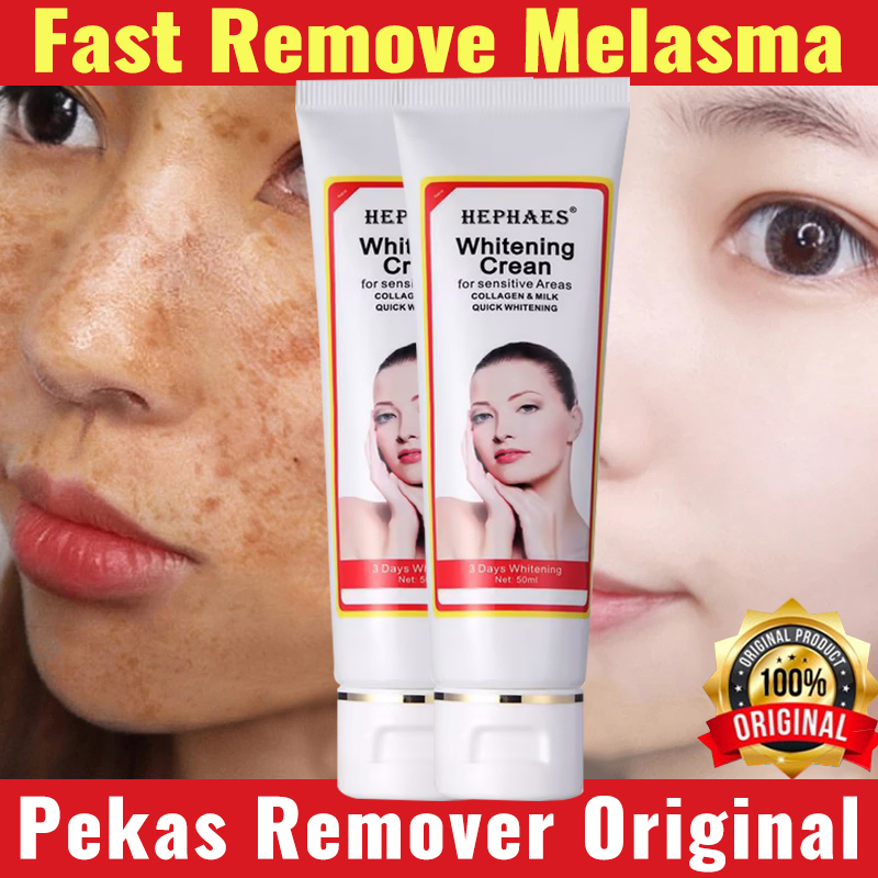 Effective Melasma Cream Pekas Remover Whitening Freckle Cream Anti Dark ...