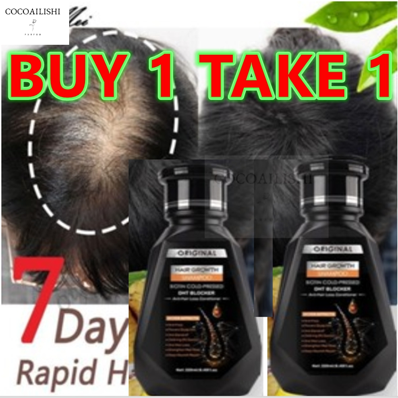 Anti Hair Loss Shampoo Treatment Hair Growth Stimulating Shampoo For ...