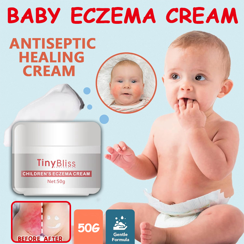TinyBliss Antiseptic Baby Skin Healing Cream Baby Eczema Cream Rash ...