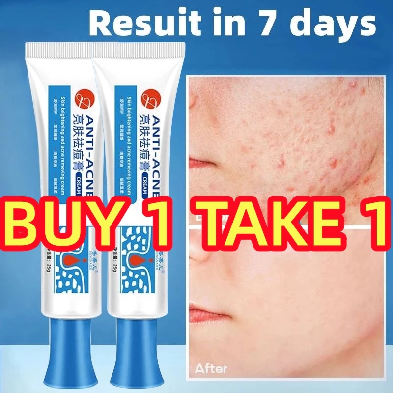Effective Remover Acne Cream Fades Acne Marks Repairs Acne Pits Facial Scar Care Shrink Gel ...