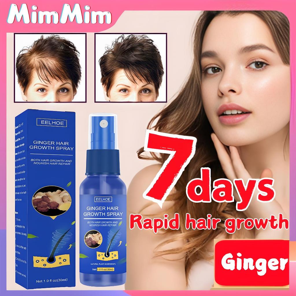 Ginger Hair Growth Serum Fast Hair Growth Spray Minoxidil Treatments ...