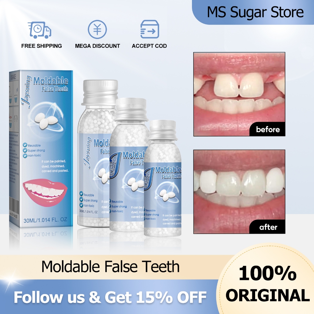 Jaysuing Temporary Tooth Repair Kit 30ml Filling Teeth Gaps Moldable ...