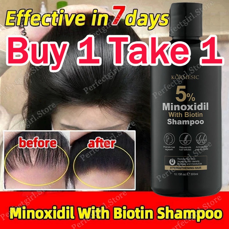 Minoxidil Hair Grower Shampoo with Biotin Regrowth Anti-Dandruff Anti ...