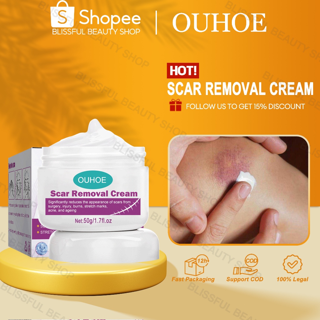OUHOE Scar Remover Cream Removal Mosquito Bite Scar Keloid Scar Old ...
