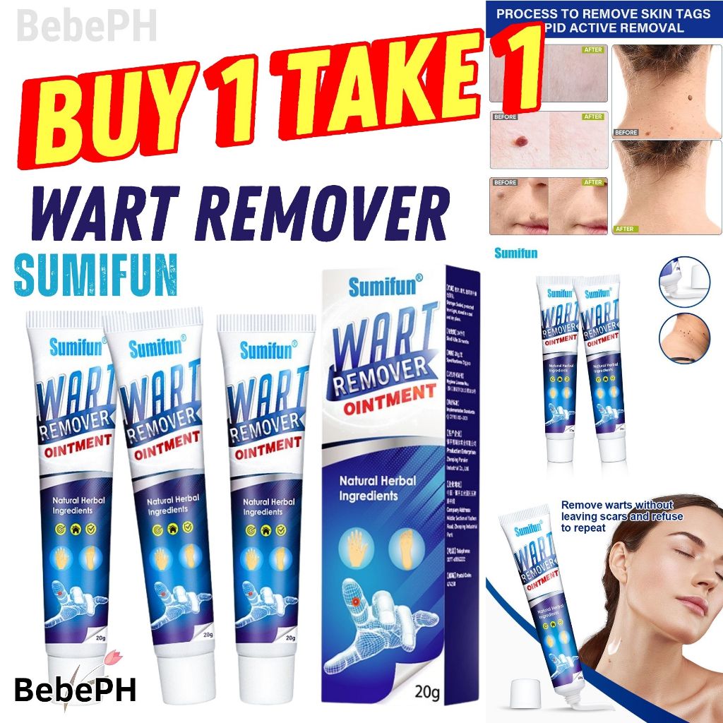 bebe.ph Warts Remover Cream Kulugo Skin Tags Moles Remover Warts ...