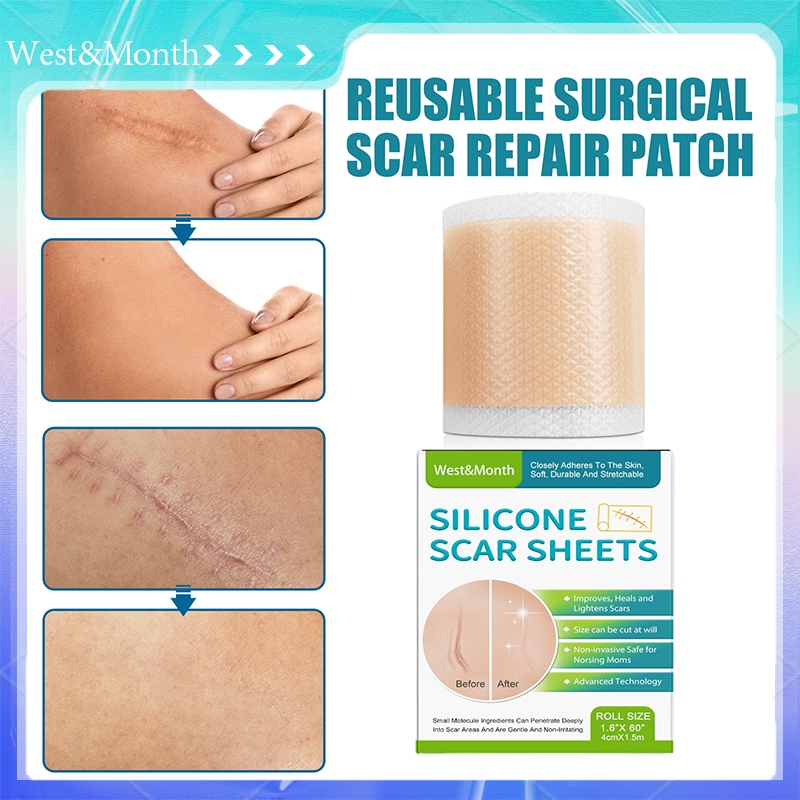 West&Month Silicone Scar Patch 4*150cm/1pcs Fade all kinds of scars ...