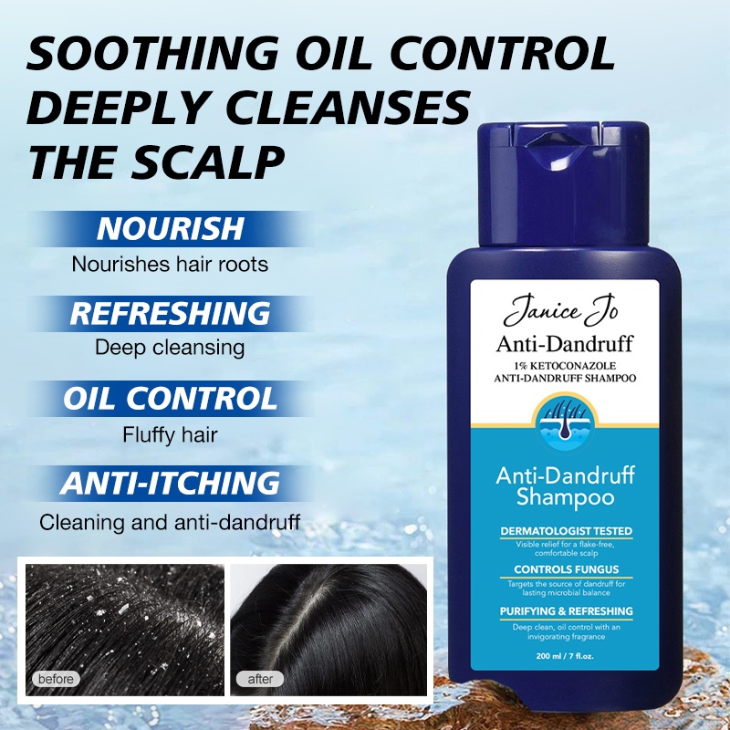 1% Ketoconazole Anti Dandruff Shampoo 200ml Effective Itch Fungal ...