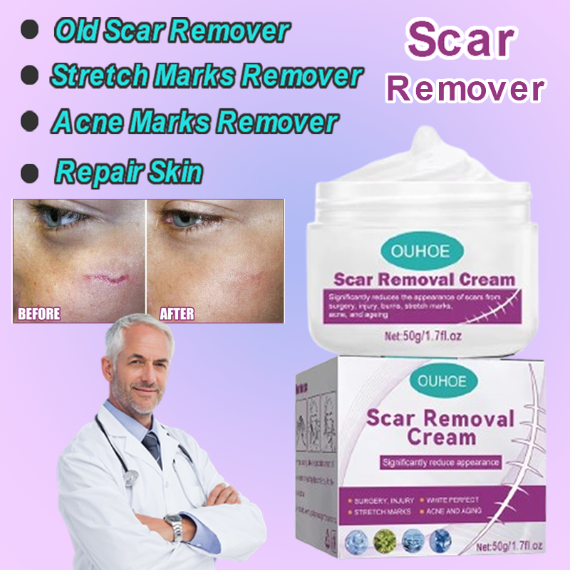 SWEETRIP Scar Remover Cream Old Scar Peklat Remover Cream Acne Pimple ...