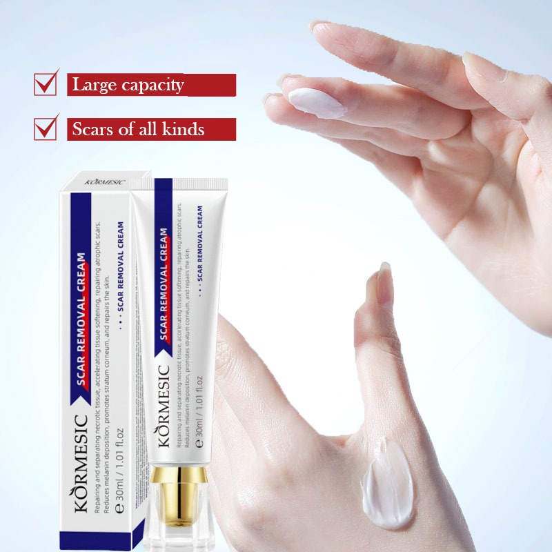 Scars Remover Cream Gel From Japan For Old Scar Care Pampatanggal Ng ...