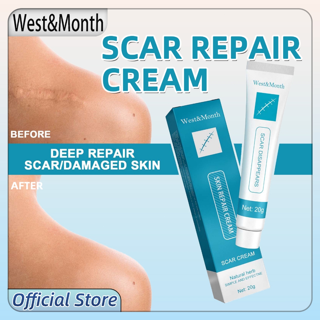 West&Month Scar Repair Ointment 20g Lighten The Scar Hyperplasia Caused ...