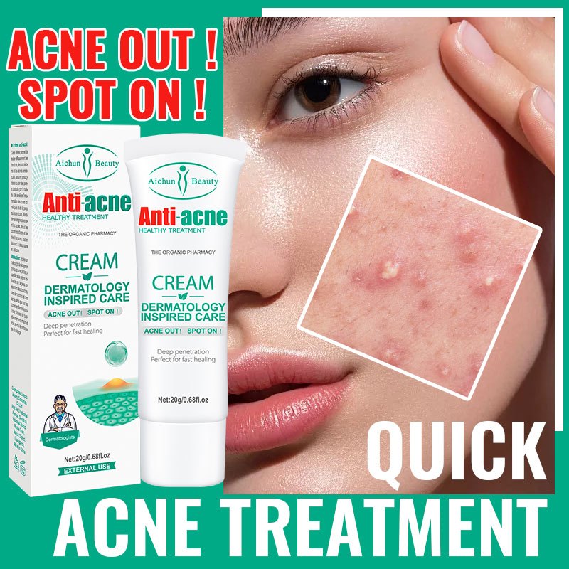 Acne cream remover anti Acne Treatment Face Serum pimple remover cream ...