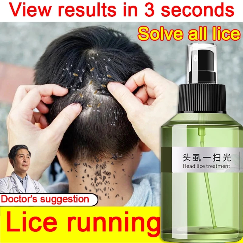 【BUY 1 TAKE 1】lice shampoo lice shampoo lice shampoo for kids kuto and ...