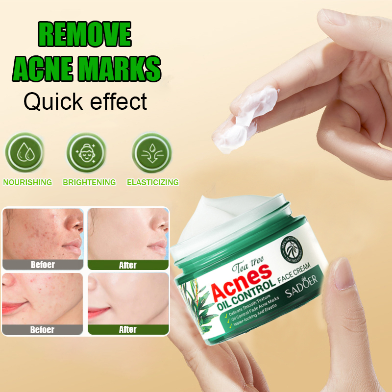 Pimple acne remover Effective Pimple Treatment Helps Calm Red Angry ...