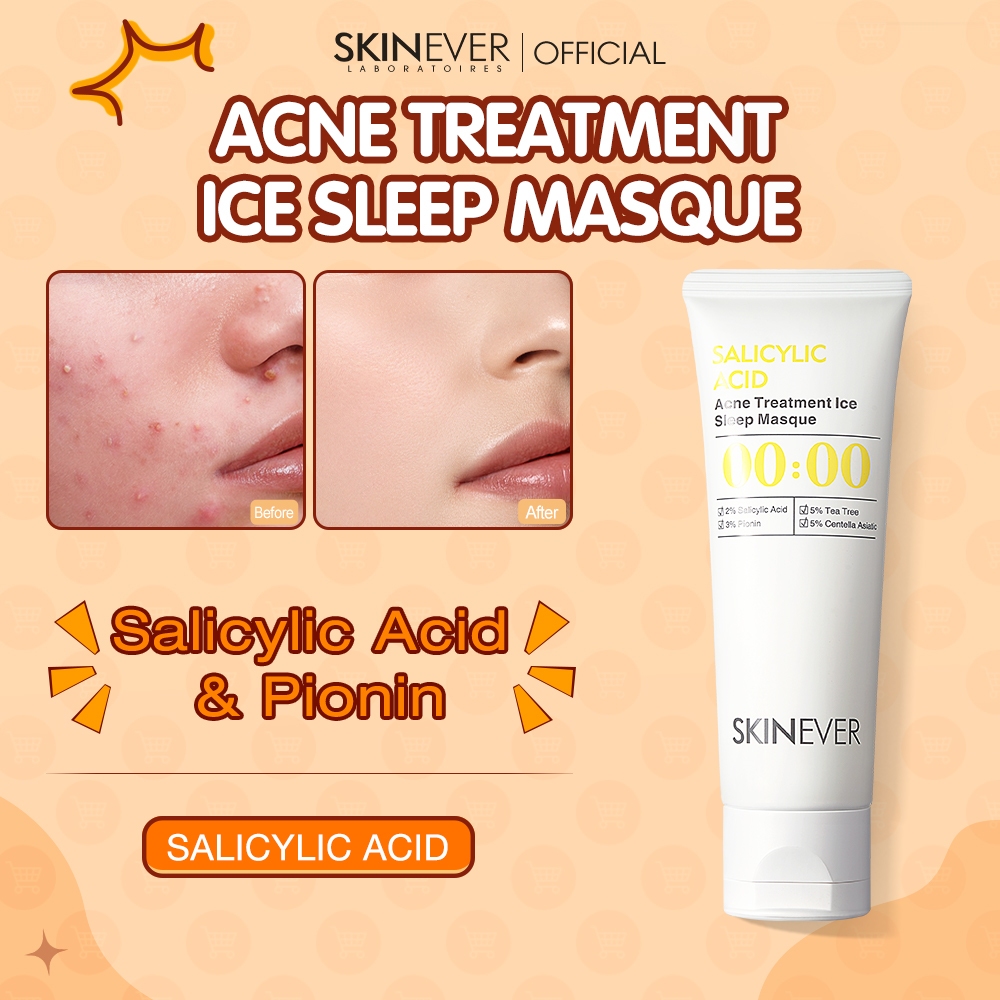 SKINEVER Salicylic Acid Acne Ice Sleeping Leave-On Mask Acne Treatment ...