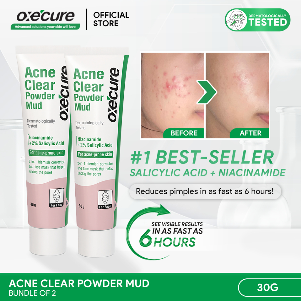 OXECURE 2% Salicylic Acid Acne Clear Powder Mud 30g | Shopee Philippines