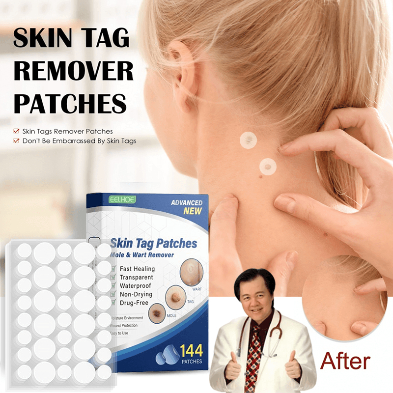 144PCS/Box Warts Remover Patch Safe Painless Skin Tag Remover Patch ...