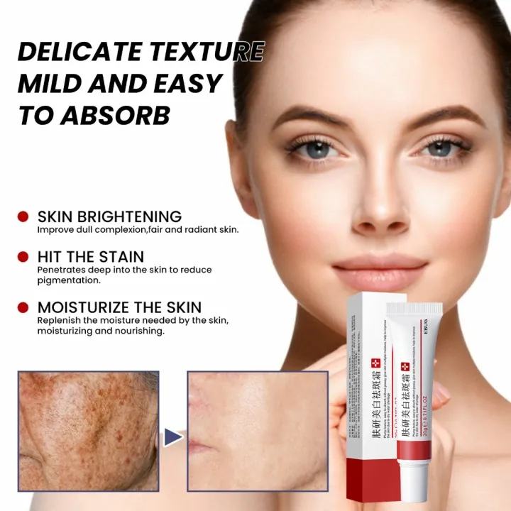 Whitening Freckle Removal Cream Brightens Skin Fades Discoloration Dark Spots Melanin | Shopee ...