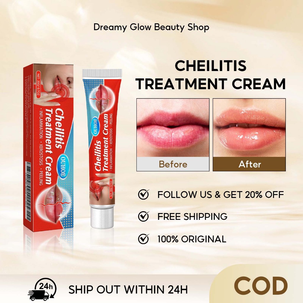 OUHOE Cheilitis Treatment Cream 20g Cold Sore Antibacterial Ointment Cheilitis Lip Moisturizing ...