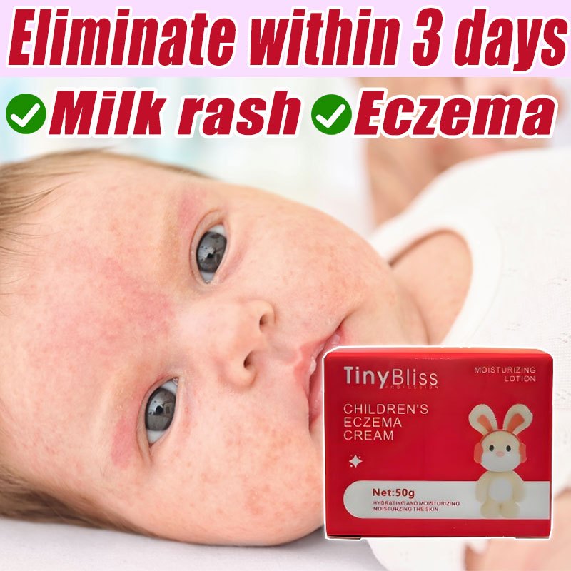 Tiny Bliss Baby rashes cream 50g anti alergy for baby rash rashes cream ...
