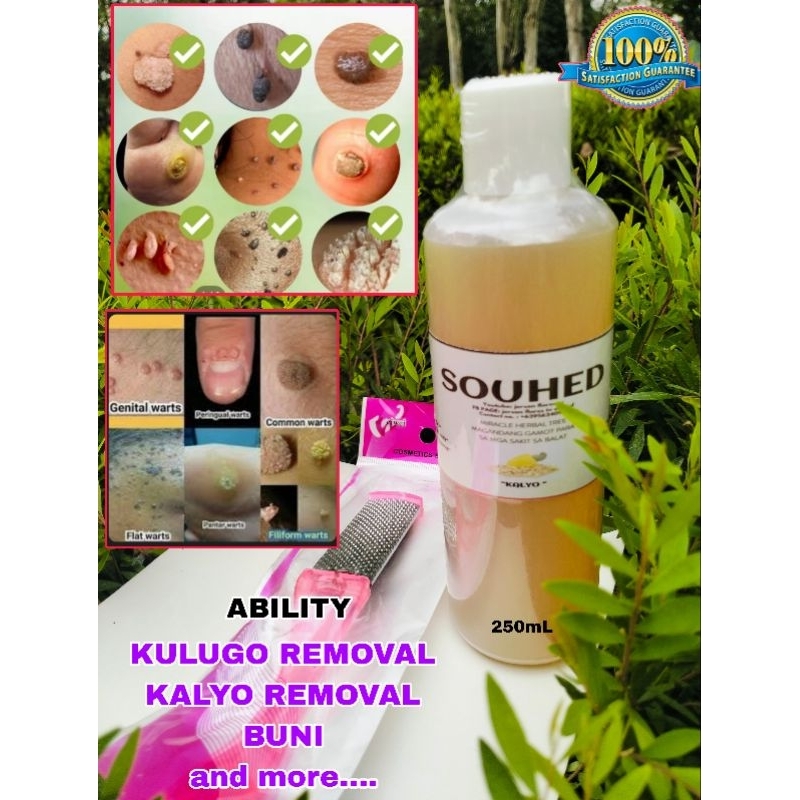 SOUHED 250mL‼️ KALYO REMOVAL/ KULUGO REMOVAL/ALIPUNGA/ BUNI/ EKSEMA/ AN ...