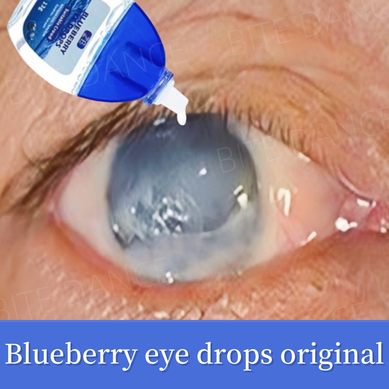Blueberry eye drops original clear eye sight drops Treatment dry eyes ...