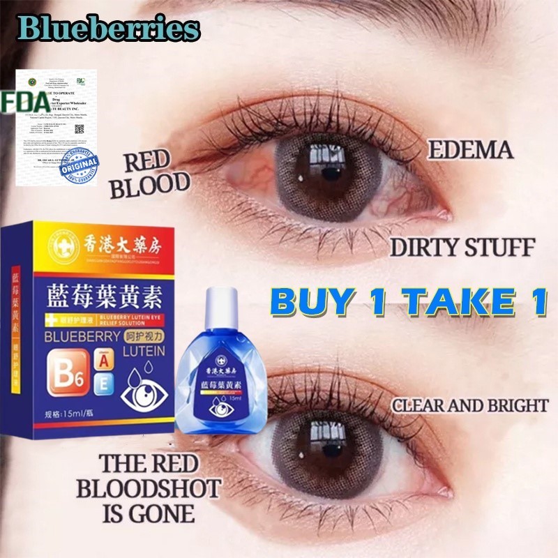 【FDA】Blueberry Eye Drops | Itchy Eyes | Glaucoma | Eye Drops | Dry Eyes ...