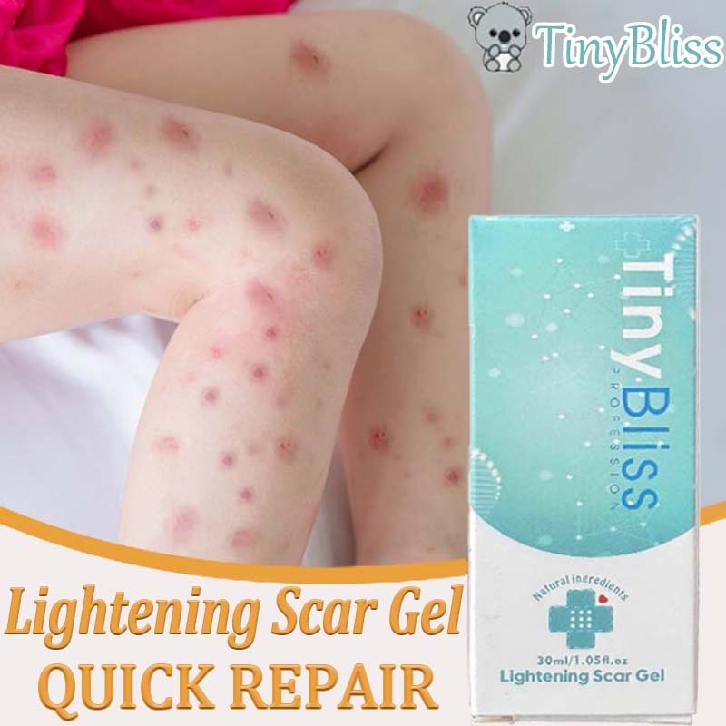 TinyBliss Lighten Up Baby Scar Gel Lightening Scar Gel 30ML | Shopee ...
