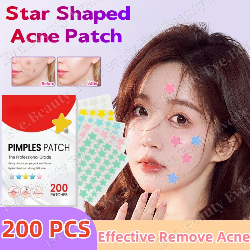 200PCS Star Pimple Patch Acne Patches for Face Blemish Treatment ...