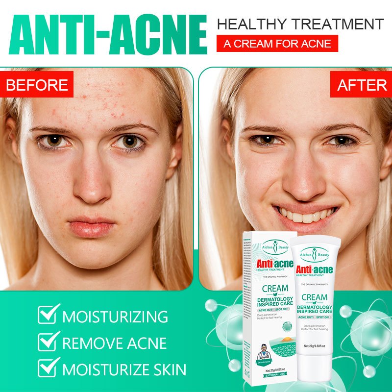 Ance Remove Cream Pimples Fades Acne Marks Suitable For Sensitive Skin ...