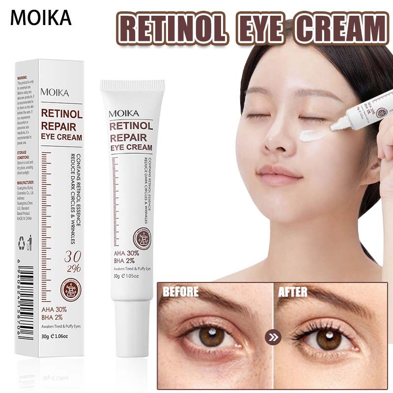 MOIKA anti eyebag cream 30g dark circles and eyebags remover retinol ...
