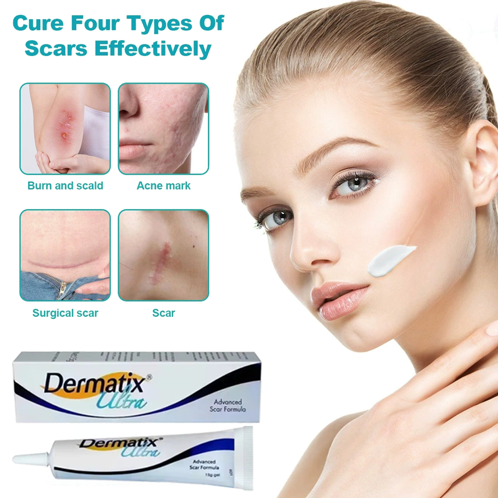 Dermatix Ultra Scar And Acne Mark Removal Gel Ointment Scars repair ...