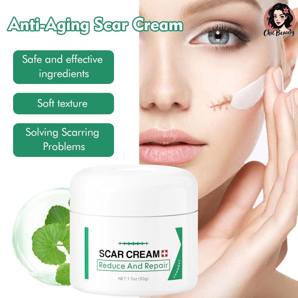 50ml Scar Remover Cream Remover Acne Old Scars Acne Stretch Mark Scald ...