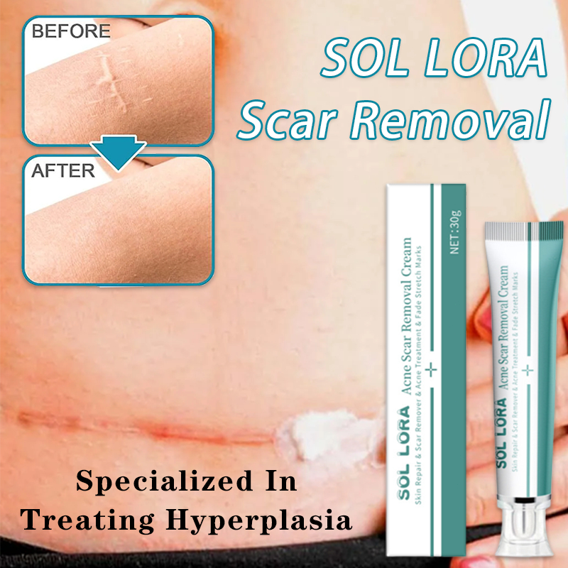 SOL LORA Scar Remover Cream Original 30g Suitable For Both New And Old ...