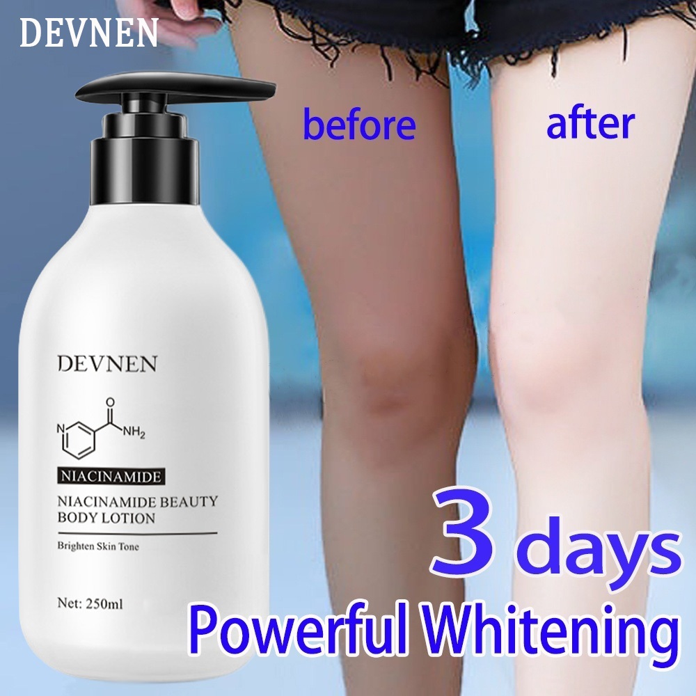 DEVNEN Niacinamide Whitening Body Lotion Moisturizing Skin Care Healthy ...