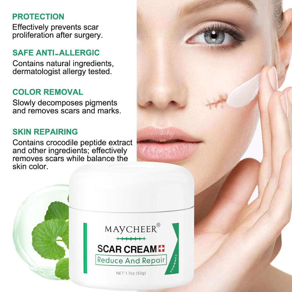 Effective Scar Remover Cream For Legs Old Scars Acne Surgical Stretch ...
