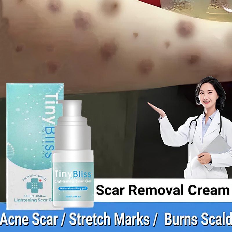 TinyBliss Lighten Up Lightening Scar Gel Baby Scar Remover peklat Scar ...