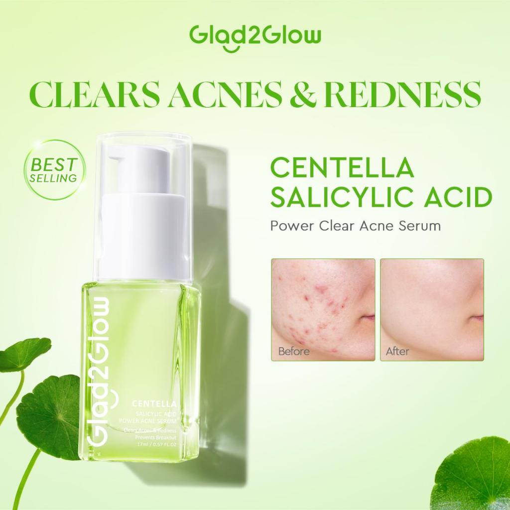 [G2G] Glad2Glow 2% ACSD Salicylic Acid 4% Niacinamide Hyaluronic Acid ...