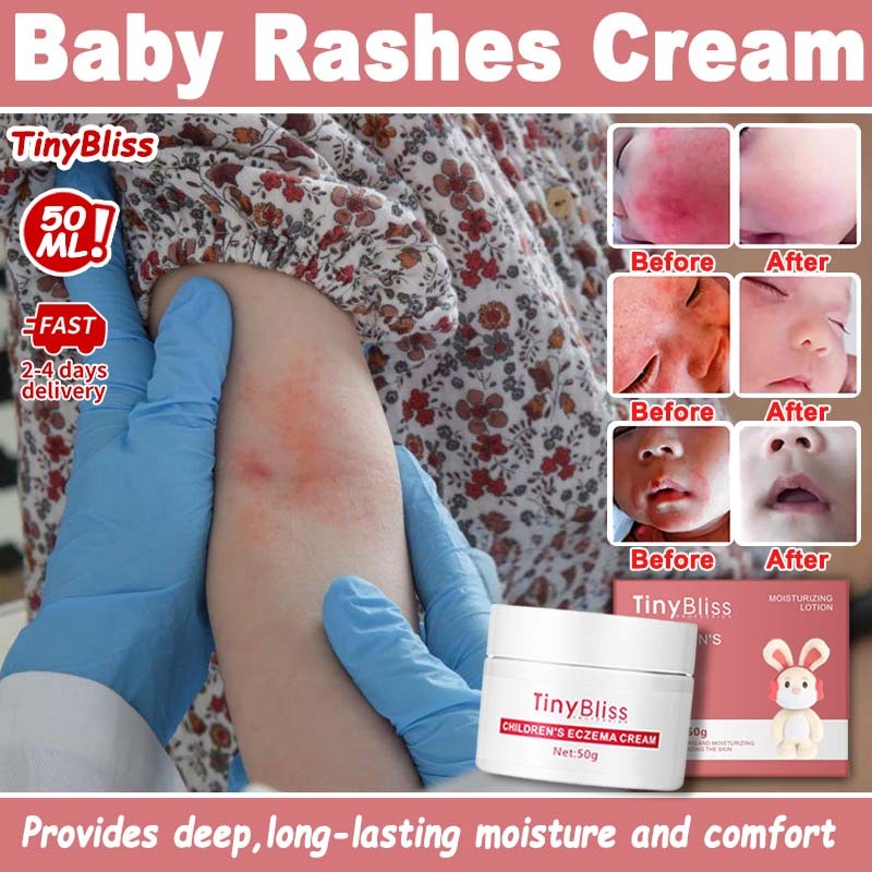 TinyBliss Baby Rashes Cream 50g Antiseptic Baby Skin Healing Cream ...